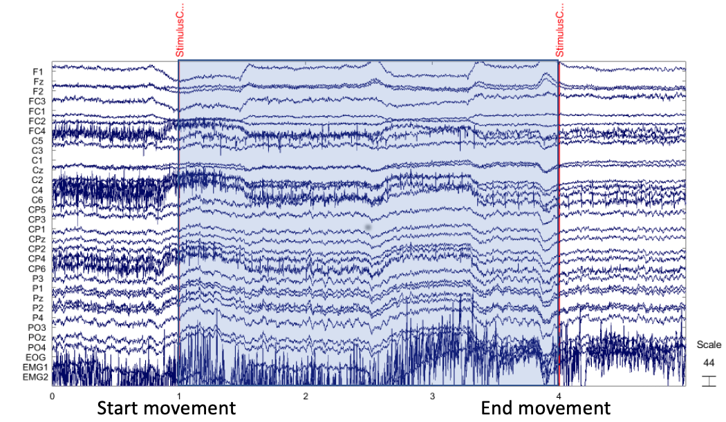 EEG classification